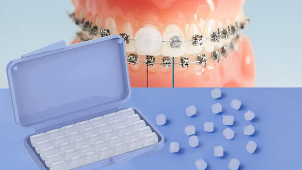¿Cómo usar la cera dental?